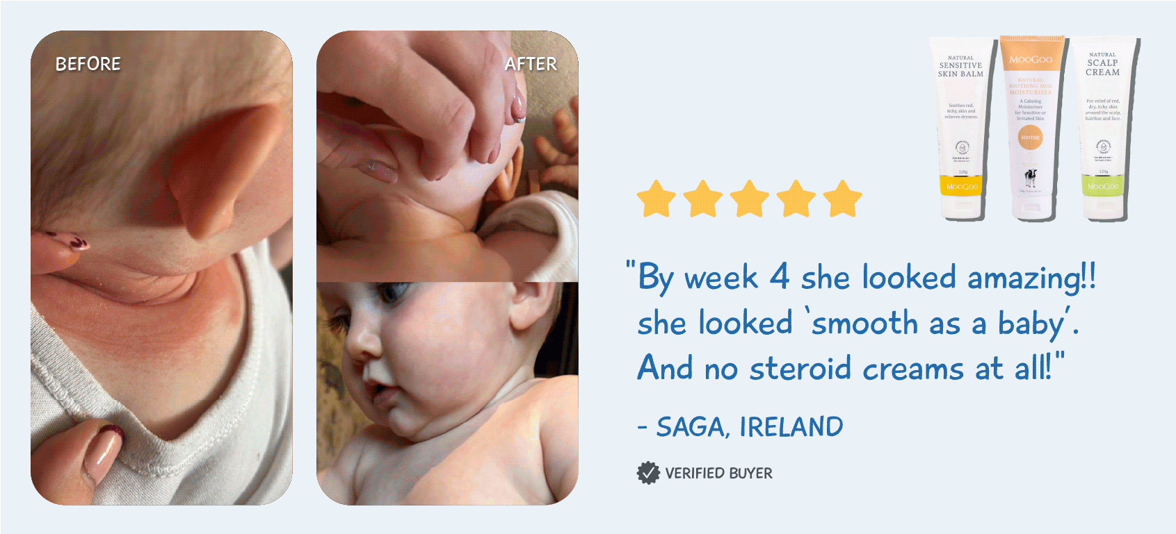 Therapy Range | Suitable for Eczema, Psoriasis, Dermatitis & TSW ...