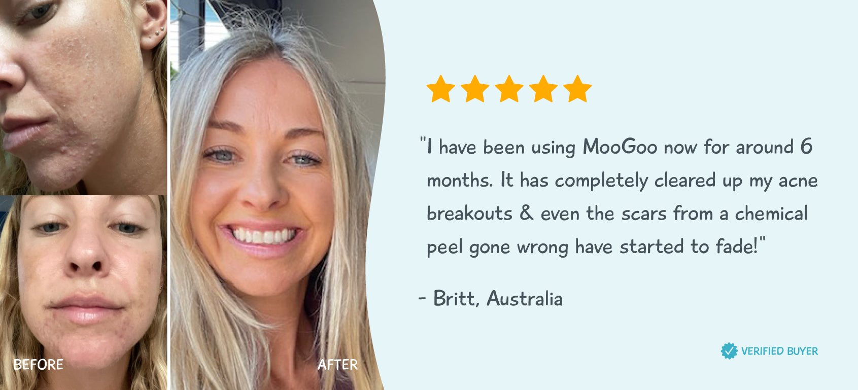 Face Creams – MooGoo UK